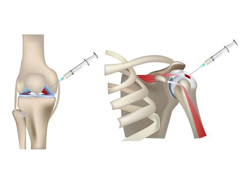 1 For Orthobiologics In Mcallen Best In Texas