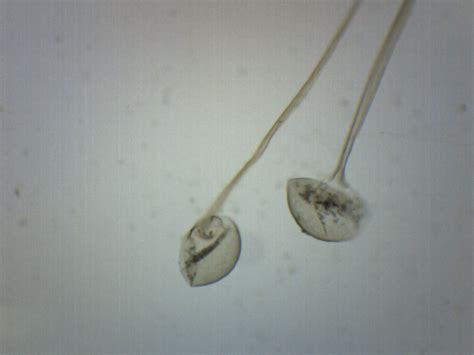 Clostridium Under Microscope Biology Notes Online
