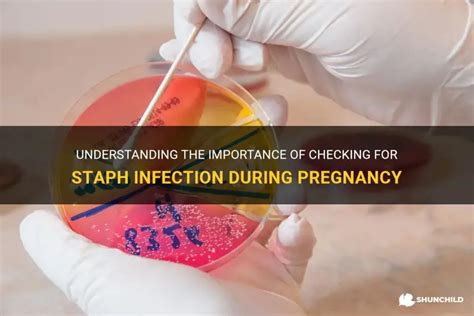 Understanding The Importance Of Checking For Staph Infection During