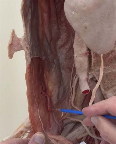 Posterior Rectus Abdominis Diagram Quizlet