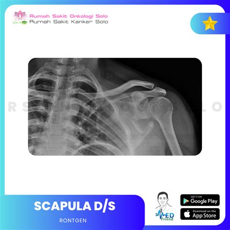 Rontgen Scapula D S