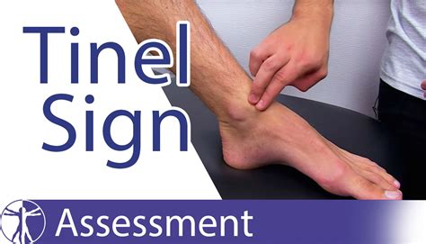 Tinel Sign At The Ankle For Peripheral Nerve Injury Tarsal Tunnel
