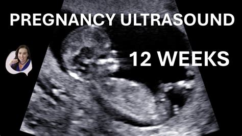 12 Weeks Pregnancy Ultrasound Video Youtube