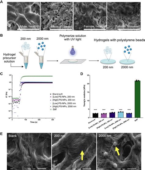 Y Chromosomelinked Uty Modulates Sex Differences In Valvular
