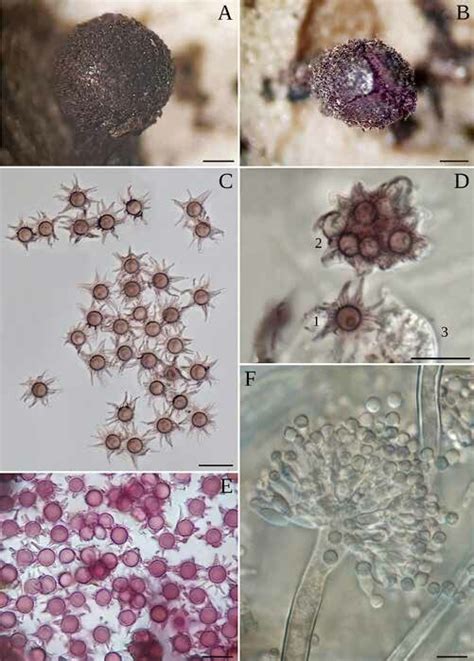 Aspergillus Stellatus Curzi A B Cleistoteci Sobre Lhoste C I E