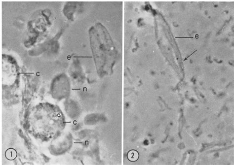 Figure 1 From The Isolation Of The Membrane Of The Toad Bladder