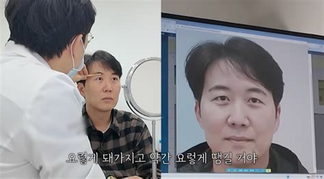장윤정♥ 도경완 성형외과 찾은 이유처진 눈에 성형 상담까지