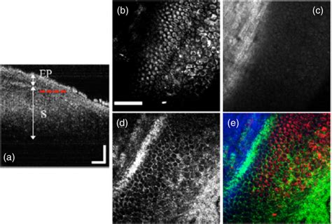 Oct Multiphoton Microscopy Mpm And Optical Coherence Microscopy Download Scientific Diagram