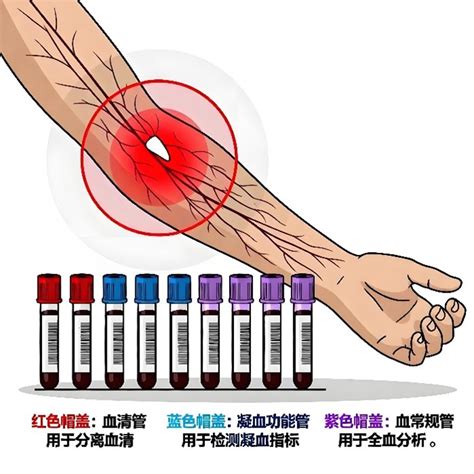「科普」血常规检查：身体的 健康小警报”，这些指标要了解！ 健康教育 漯河市中心医院