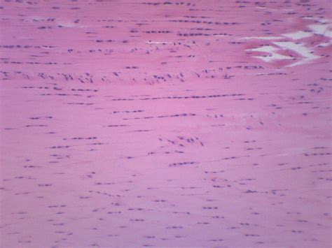 Connective Tissue Under Microscope