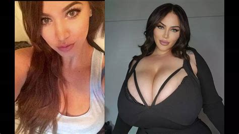 Onlyfans Models Breasts Grow 6 Cup Sizes In 14 Months Due To Rare