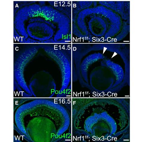 Delayed Onset Of Rgc Differentiation In Nrf1 Ff Six3 Cre Retina