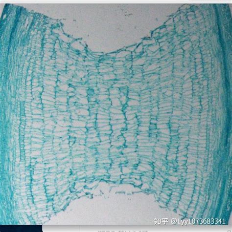 石蜡切片：大豆茎杆、茄子茎杆纵切注意事项 知乎