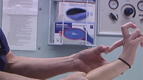 Multidirectional Instability—arthroscopic Treatment And Outcomes