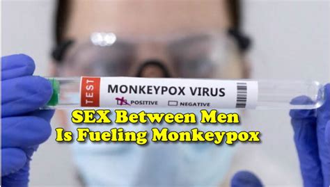 Growing Evidence Indicates Sex Between Men Gay Is Fueling Monkeypox