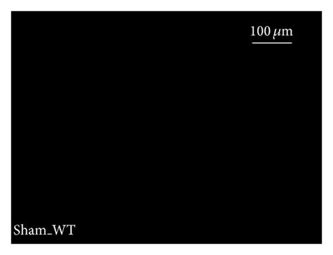 Hepatic Hypoxia Was Assessed By Immunohistological Staining Of