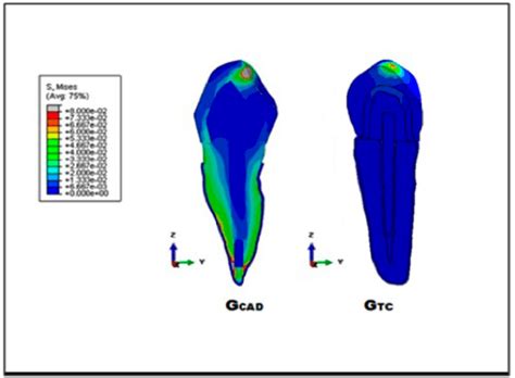 Vms Stress Distribution Mpa In All Groups Download Scientific Diagram