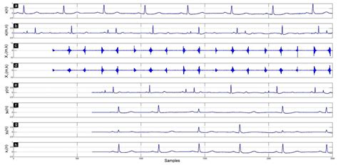 Electronics Free Full Text Efficient Fpga Based Architecture Of The Overlap Add Method For