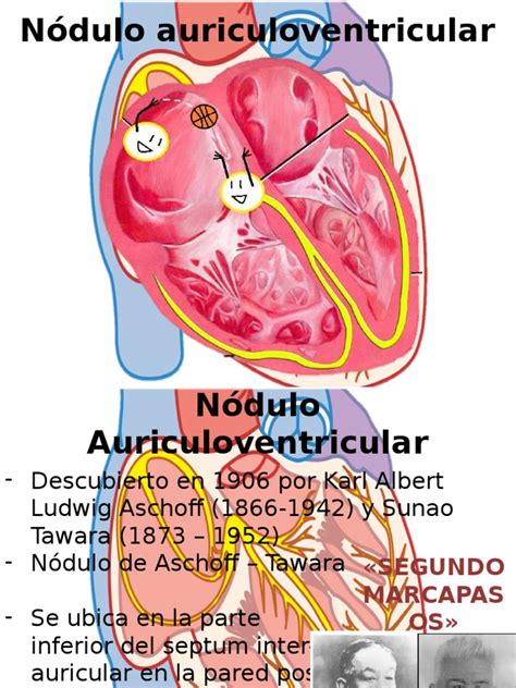 Nódulo Auriculoventricular Pdf
