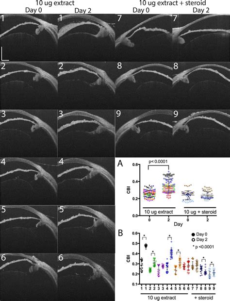 Quantification Of Ciliary Body Inflammation Using The Cbi 1 9