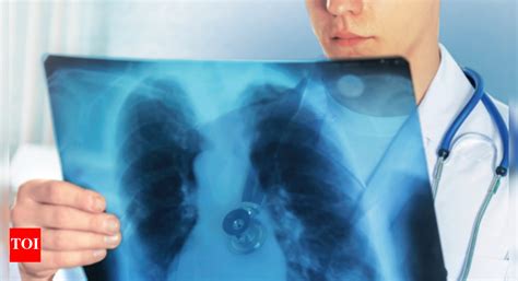 Molecular Testing Molecular Testing To Replace Age Old Sputum For Tb Detection Mumbai News