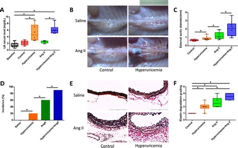 Hyperuricemia Aggravates Aaa Formation In Mice Hyperuricemia Markedly Download Scientific