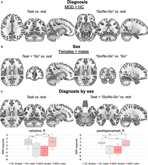 Sexual Dimorphism In The Brain Correlates Of Adult Onset Depression A Pilot Structural And