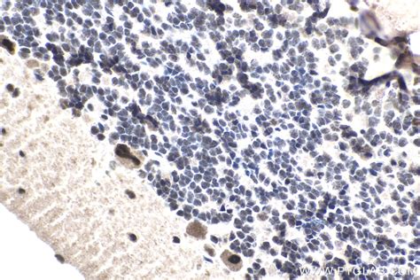 Ihceasy Foxp4 Ready To Use Ihc Kit Khc1818 Proteintech