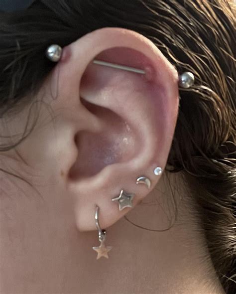 Keloid Or Piercing Bump Rpiercingadvice