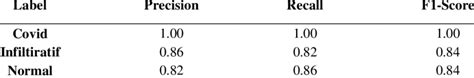 The Cnn With Resnet Backbone Model Performance Metrics Download
