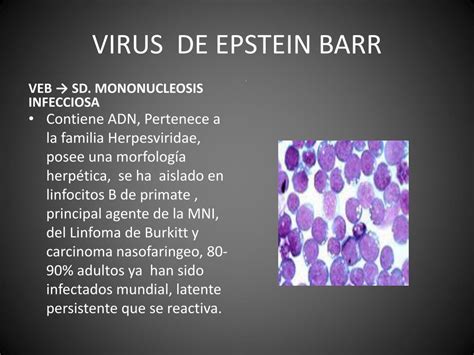 Ppt Viruela Powerpoint Presentation Free Download Id 2274180