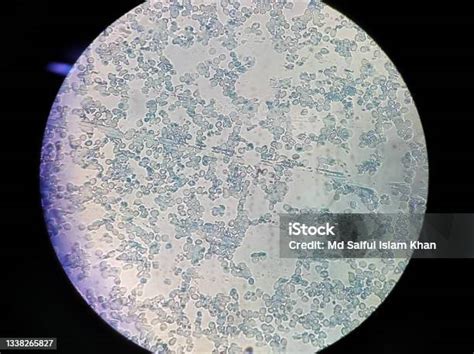 Reticulocyte Count From Blood Smear Microscopic Close View Hematology