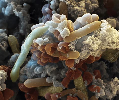 Dechlorinating Bacteria Sem Stock Image C0090761 Science Photo
