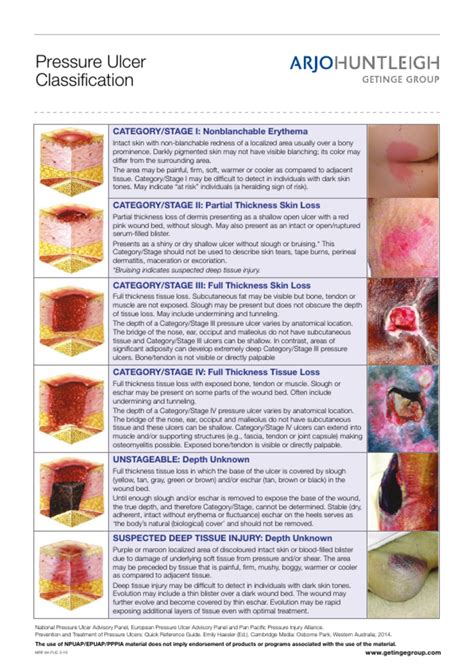 Pressure Ulcer Classification Guide Pdf Download