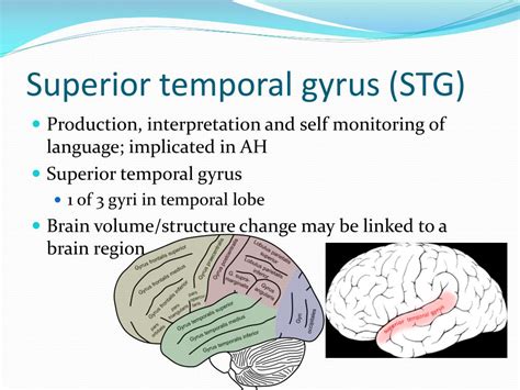 Ppt Schizophrenia Powerpoint Presentation Free Download Id3849487