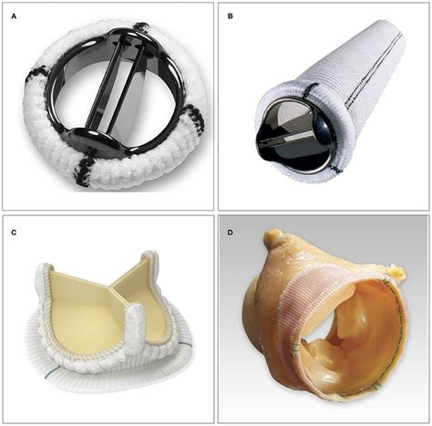 Types Of Aortic Valves Aortic Valve Suov