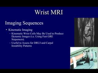 Wrist Mri Magnetic Resonance Imaging Ppt