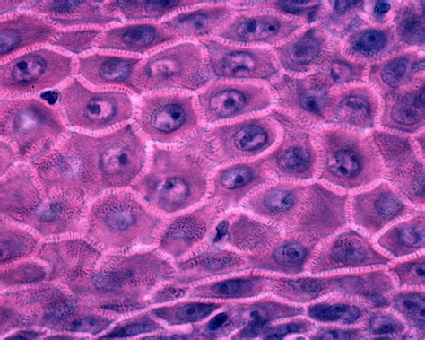 Desmosomes In Epidermis Light Micrograph Stock Image C0406780