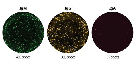 Fluorospot Flex Mouse Igm Igg Iga Mabtech