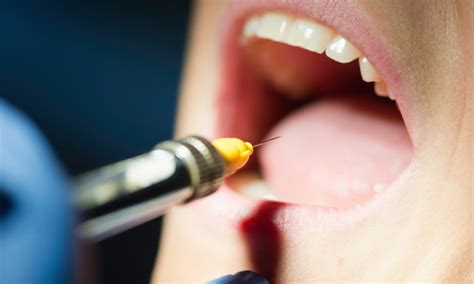 Cracked Tooth Repair Cost In Avondale Az Desert Lake Dental