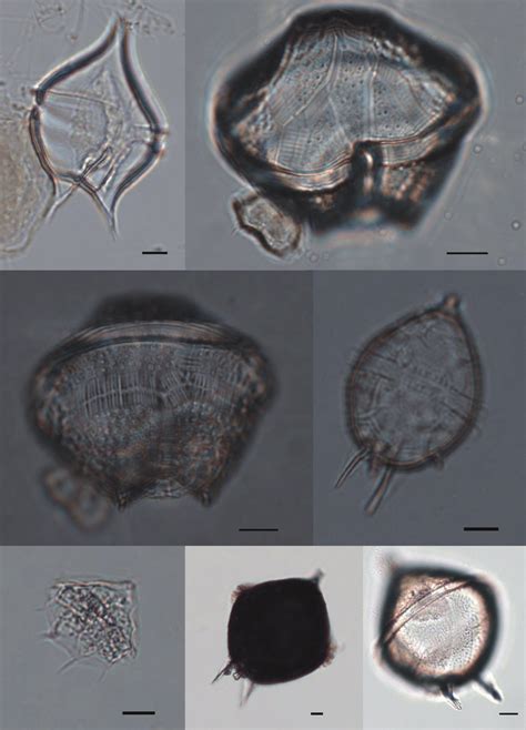 Light Microscopy Lm A Protoperidinium Oblongum Ventral View B