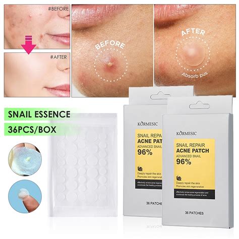 Acne Patches Snail Essence Oily Skin Tone Invisible Sticker Face Acne