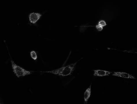 Normalization Of Fluorescence Images Image Analysis Imagesc Forum