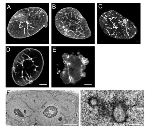 Figure 3 From The Role Of Lamins In The Nucleoplasmic Reticulum A Pleiomorphic Organelle That
