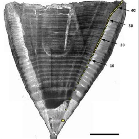 Sagittal Section Of A Vertebra Of Sphyrna Mokarran Female Of 424 Cm Of Download Scientific