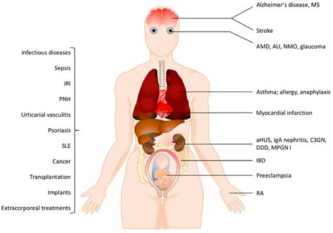 Examples Of Pathological Conditions Involving The Complement System