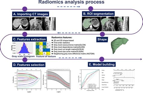 Workflow For Radiomics Analysis Roi Region Of Interest Download