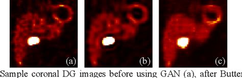 Figure 2 From Generative Adversarial Network For Denoising In Dual Gated Myocardial Perfusion