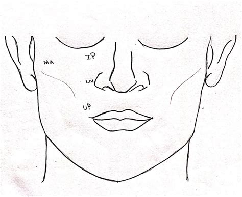 Fig 3 Four Extra Oral Sub Units Of Mid Face Region Viz