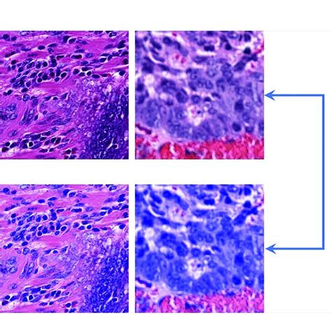 Color Normalization I Original Slice Images Ii Color Normalized Download Scientific